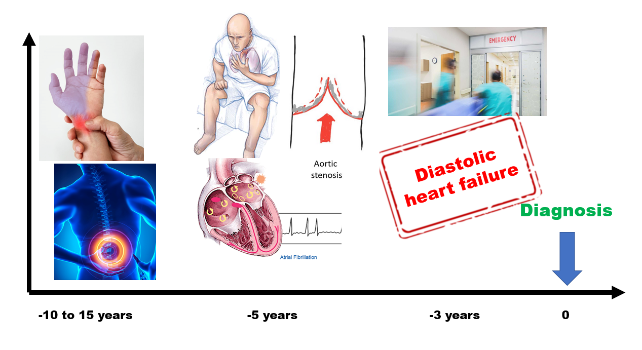 When to suspect Cardiac Amyloidosis? - Deconstructed Cardiology
